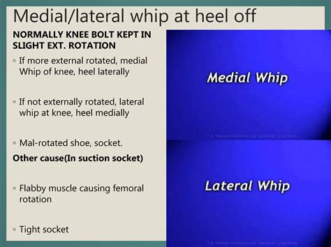 Prosthetic Gait Deviation Pptx Prosthetic Gait Deviation Pptx