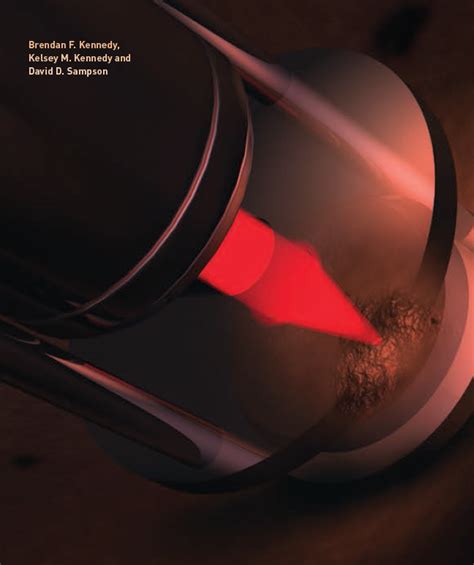 Optical Coherence Elastography Obel