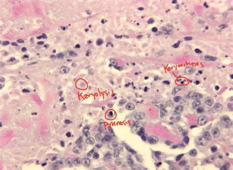 Lecture 5 Reversible And Irreversible Cell Damage Flashcards Quizlet