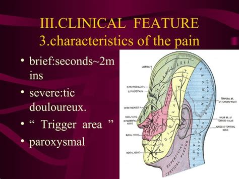 Primary Trigeminal Neuralgia Ppt
