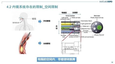 Revolutionizing Endoscope Imaging With Matlab And Simulink Morgan
