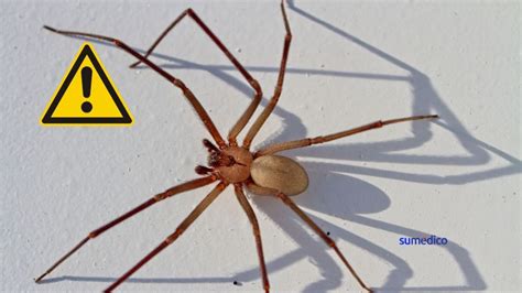 Temporada De Araña Violinista ¿qué Hacer Ante Una Mordedura Su Médico