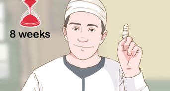Ways To Splint A Finger WikiHow