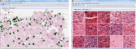 Examples Of Overlay Query And Similarity Query Download Scientific