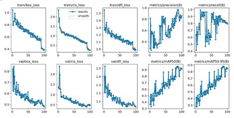 Morphometric Analysis And Tortuosity Typing Of The Large Intestine