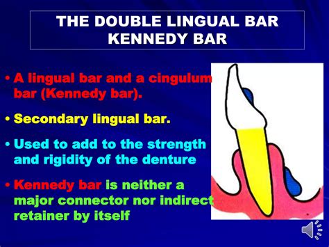 Mandibular Major Connectors And Minor Connectors Ppt