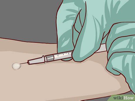 How To Read A Tuberculosis Skin Test 9 Steps With Pictures