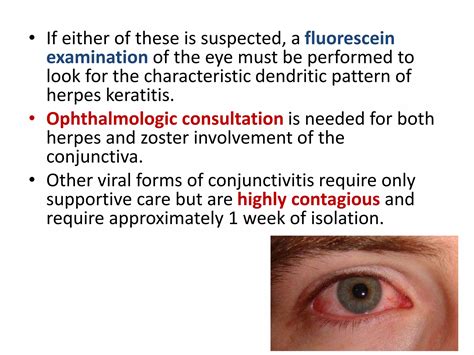 Diagnosis And Management Of Pediatric Conjunctivitis Pptx