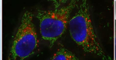 My Imagej เมนู Image With Imagej ตอนที่ 14 Stack To Rgbเครื่องมือ