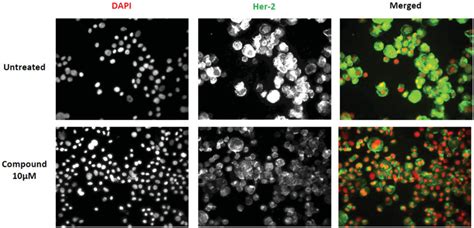 The Inhibitory Potency Of The Most Active Compound 4f On Her 2 Download Scientific Diagram