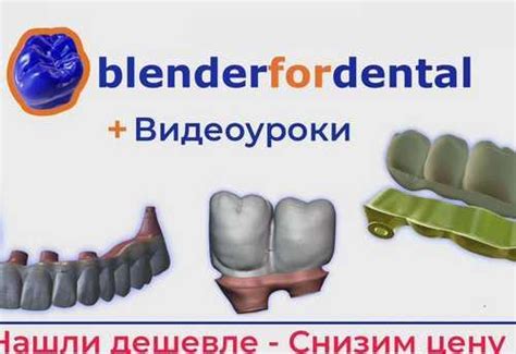 Blender For Dental B4d Ibar балки и все модули Москва Игровые приставки игры программы