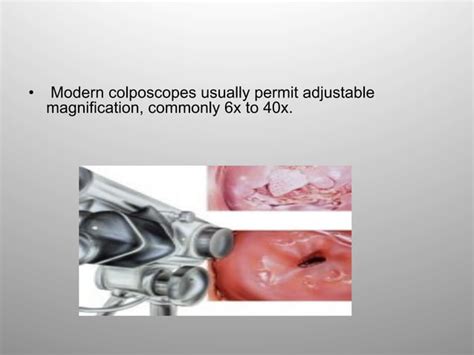 Colposcopy Nstrumentation And Principles On How To Do 22 Pdf