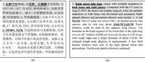 Figure 1 From Event Extraction Of Chinese Electronic Medical Records