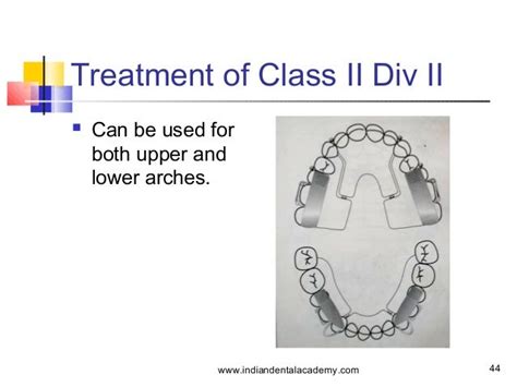 Twin Block 2 Certified Fixed Orthodontic Courses By Indian Dent…