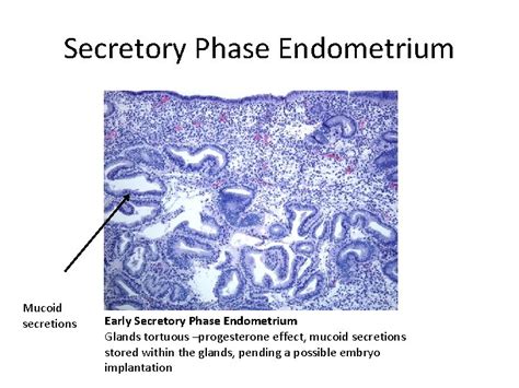 Histology For Pathology Female Genital Tract And Breast