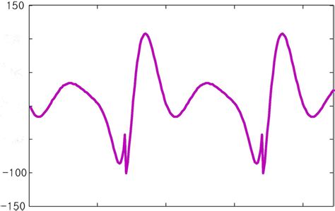 Left Knee Torque From Step Initiation To Continuous Walking Download