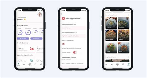 What Is Flutterflow A Comprehensive Guide Miquido Blog