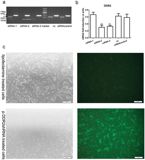 screening of discoidin domain receptor 2 ddr2 sirna and transfection