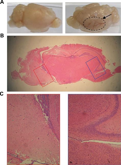 Stroke Induced By Middle Cerebral Artery Occlusion Mcao A Mcao