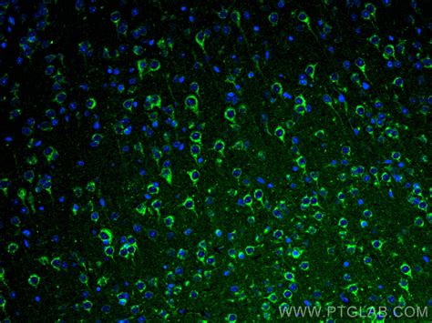 Sortilin Antibody 68007 1 Pbs Proteintech