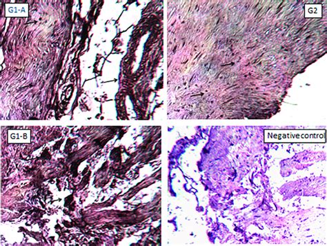 Ihc Nuclear Staining Of Et 1 In Preparations Of Human Abdominal Aortas