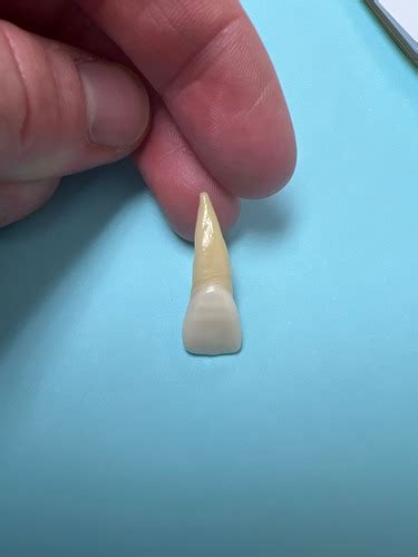 Tooth Morphology Flashcards Quizlet
