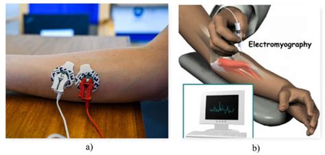 Biomimetics Free Full Text A 3d Printed Bionic Hand Powered By Emg Signals And Controlled
