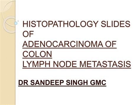 Histopathology Slides Of Pptx Cancer Diseases And Conditions