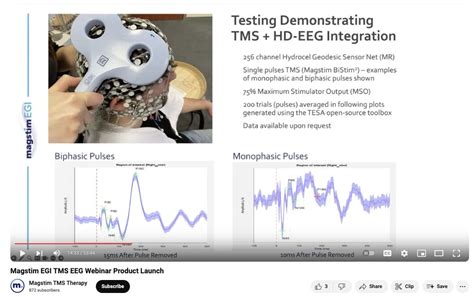 Psychology Software Tools On Linkedin Eprime Tms Eeg