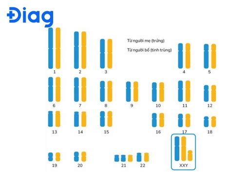 Xo Chromosome Abnormality