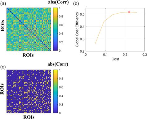 Data‐driven Topological Filtering Of A Functional Brain Network A A
