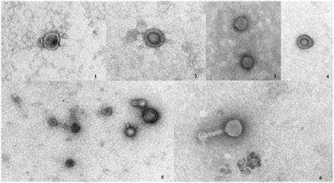 Isolation And Characterization Of Lytic Bacteriophages As An Alternative To Prevent Pseudomonas