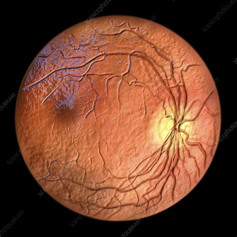 Healthy Retina Stock Image F0364333 Science Photo Library
