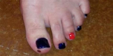 We Do Prosthetic Nails