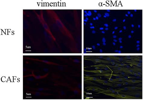 Immunofluorescence Staining Showed That Vimentin Was Positive In