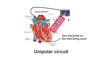 Basics Of Pacemaker Dr Hafeesh Fazulu Pushpagiri Pptx