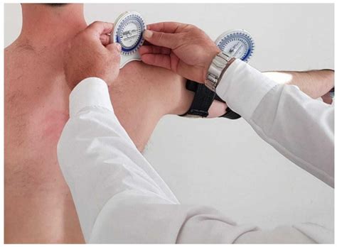 Scapular Upward Rotation Measurement Download Scientific Diagram