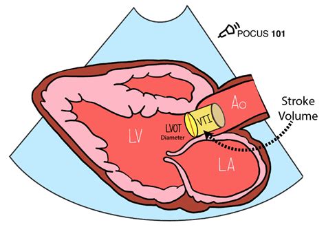 9 Cardiac Output With Echo Ultrasound Ideas Cardiac Ultrasound