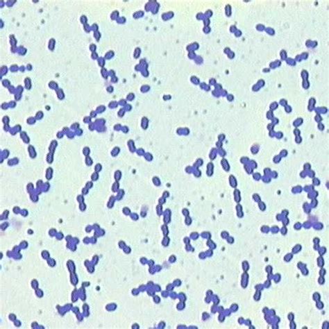Enterococcus Faecium Streptococcus Faecium
