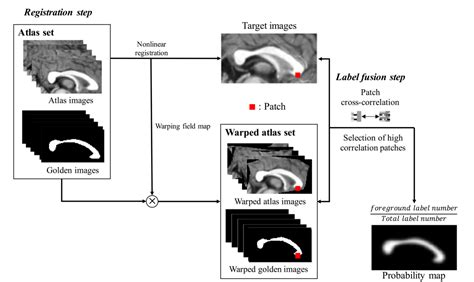 figure 2 from automatic segmentation of corpus callosum in midsagittal