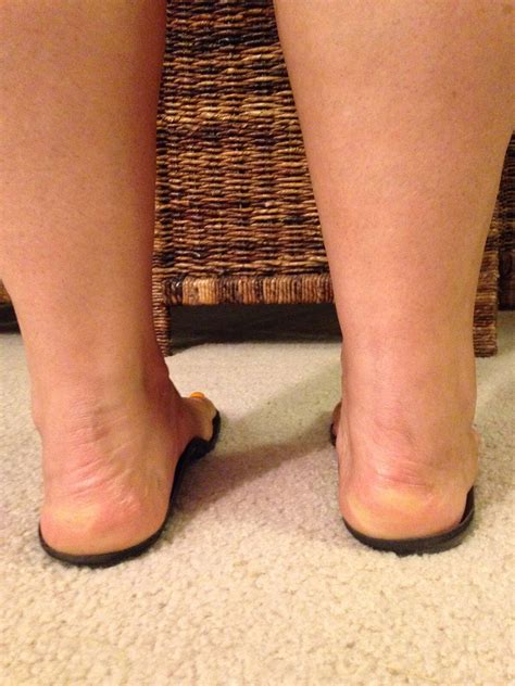 Optimal Core Alignment Align Renew Thrive