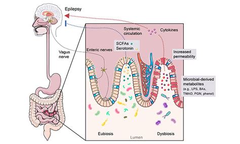 Articles Microbiome Research Reports Oae