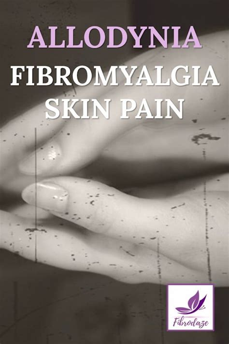 16 Photos That Show How Fibromyalgia Can Affect Your Skin Artofit