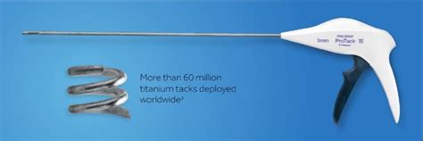 Medtronic Protack Fixation Device 30 Tacks Per Unit At Best Price In