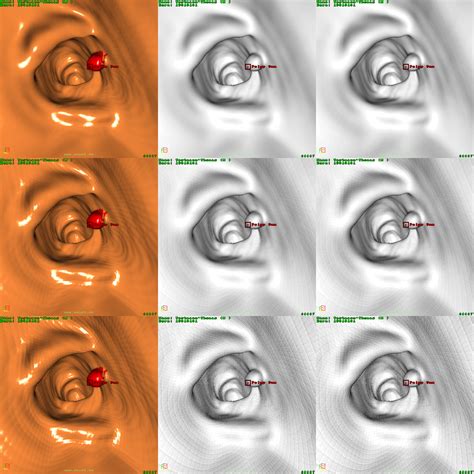 ECCET Examples Hatching