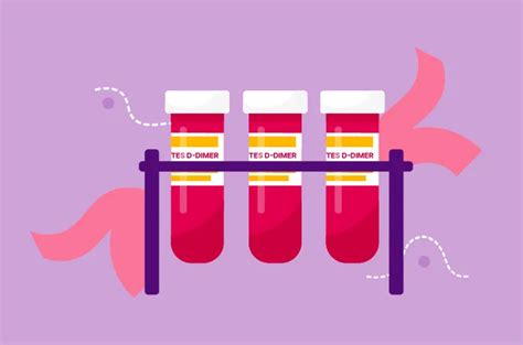 Tes D Dimer Tujuan Jenis Dan Prosedur Halodoc