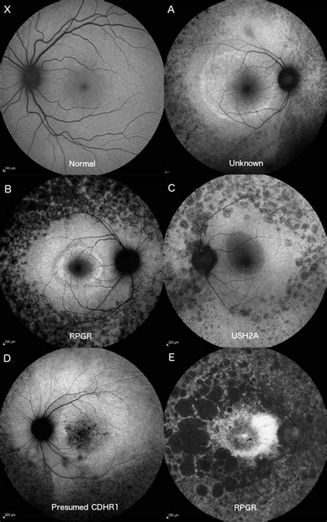 figure 1 from a novel method for quantitative serial autofluorescence