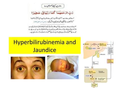 Bilirubin Metabolism And Jaundice Imp Ppt