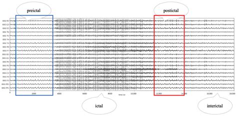 bioengineering free full text time series anomaly detection based