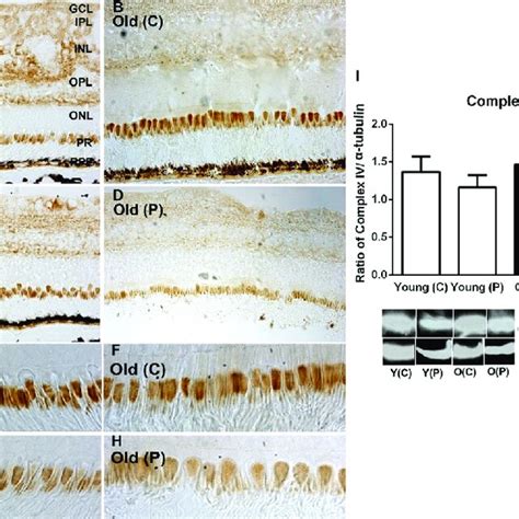 A D Immunohistochemistry Of Cytochrome C Oxidase Subunit Iii In Young Download Scientific